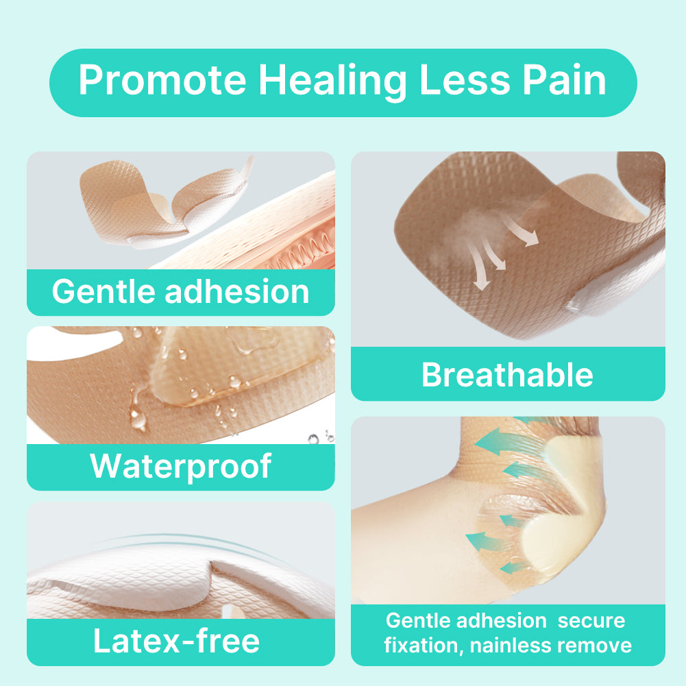 Understanding Diabetic Foot and Choosing the Right Dressings – Dimora ...