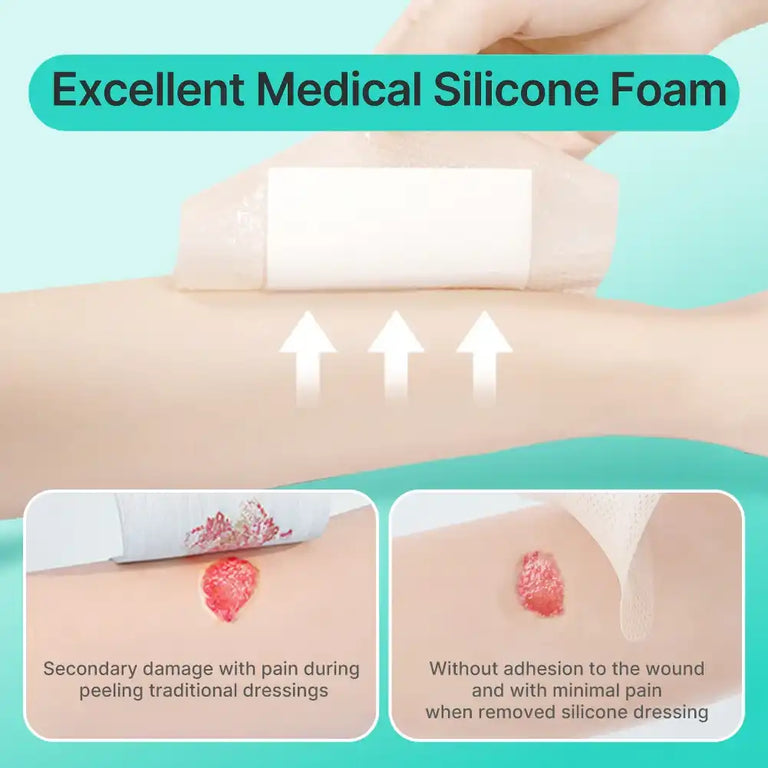 Choosing the Right Dressing for Pressure Ulcers – Dimora Medical