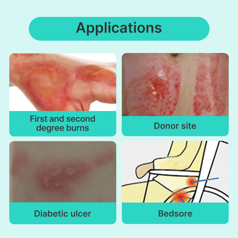 Choosing the Right Dressing for Pressure Ulcers – Dimora Medical