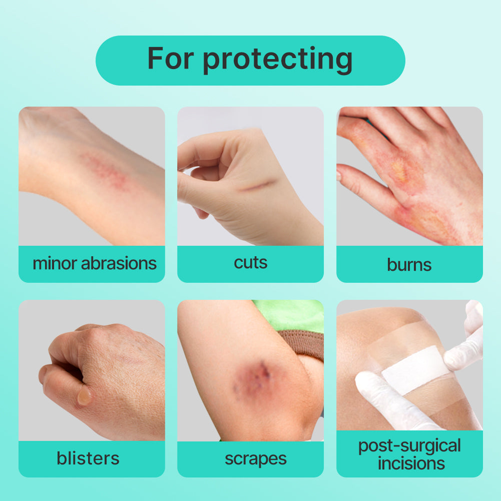 Choosing the Right Dressing for Pressure Ulcers – Dimora Medical