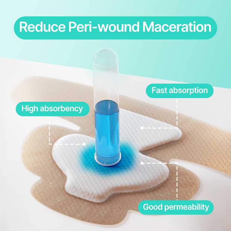 Understanding Diabetic Foot and Choosing the Right Dressings – Dimora ...